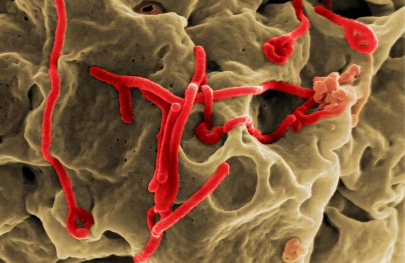 “A particularly difficult Ebola outbreak”: U of T expert on the current ...